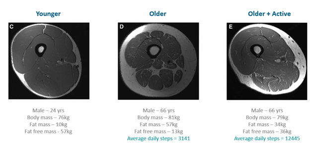 The Fight Against Sarcopenia (Muscle Loss with Aging) | Blog The Fight Against Sarcopenia (Muscle Loss with Aging) | Blog